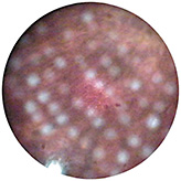 New Retinal Physician | PentaVision